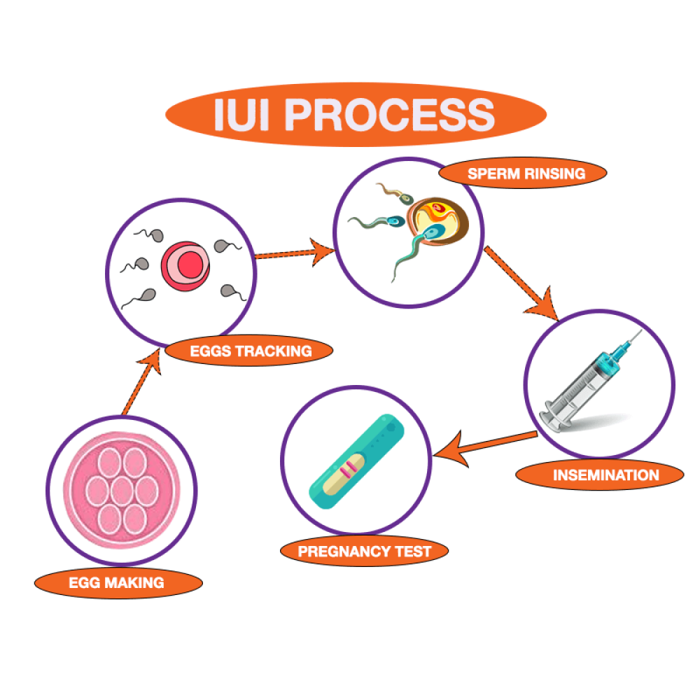 IUI, IVF – OB GYNAE